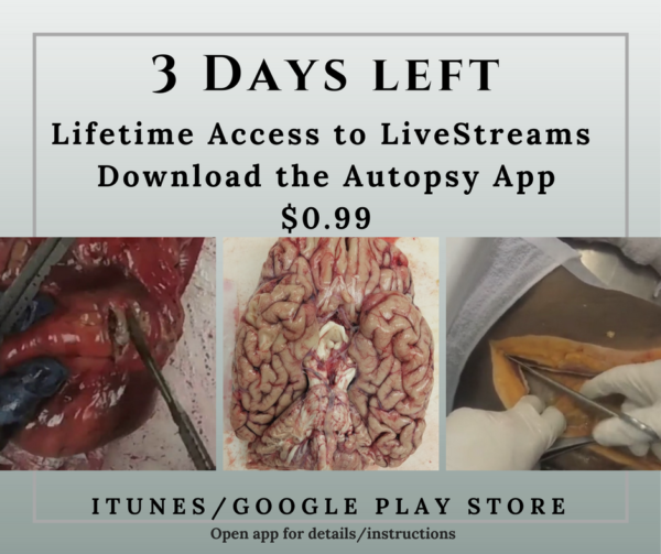 AutopsyApp311 | Autopsy Center of Chicago